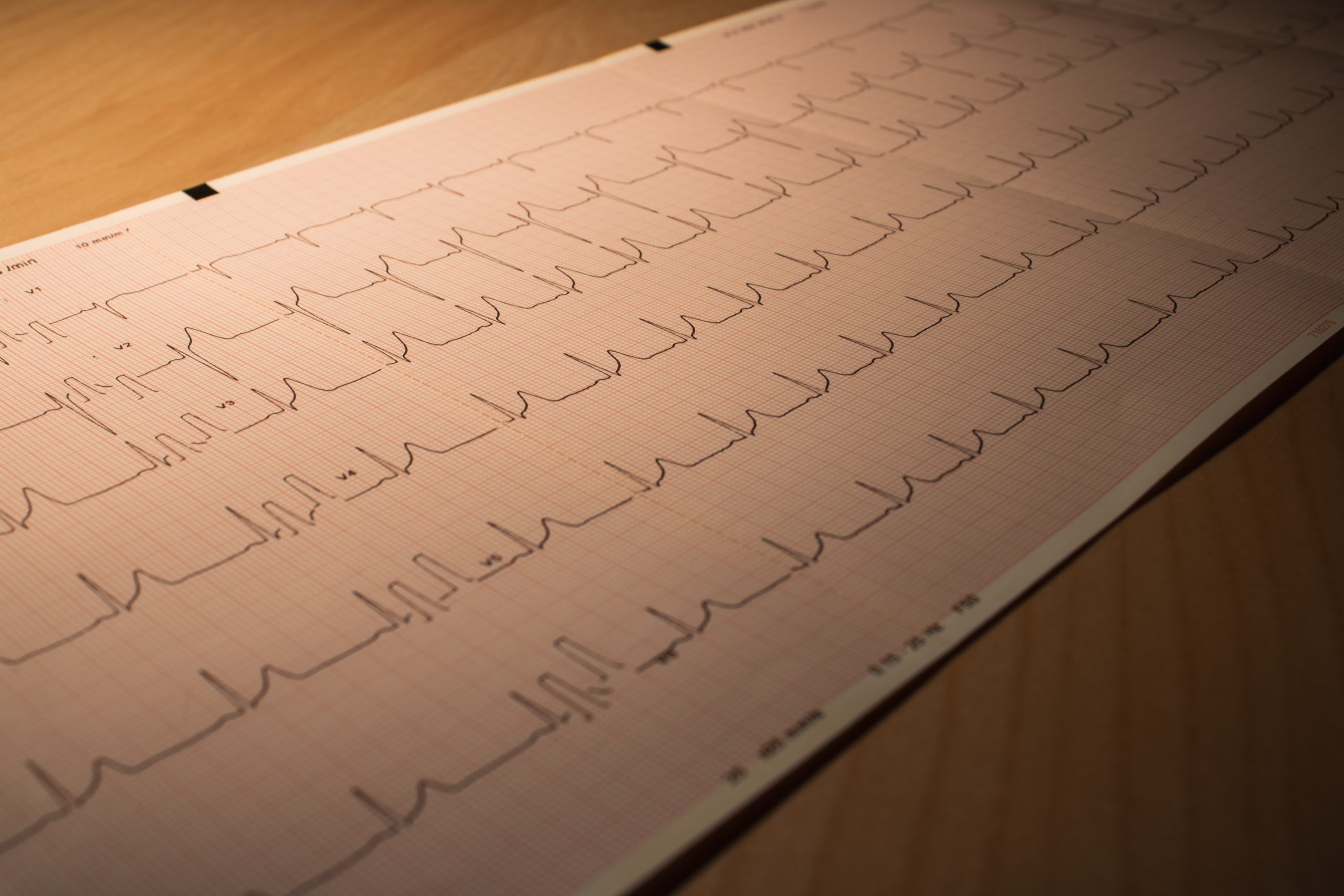 The Importance of Regular Cardiac Screenings: What to Expect